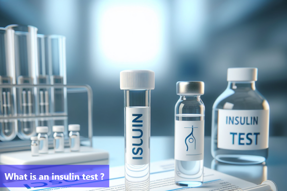 Fasting Insulin Test: What It Is and Why It's Important – DiabeSmart